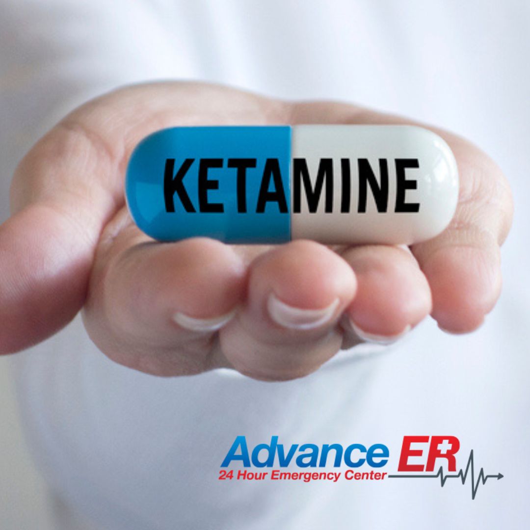 Breaking Ground in Emergency Care with Ketamine Treatments